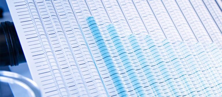Pitot Tubes and Their Role in Aviation - Armfield
